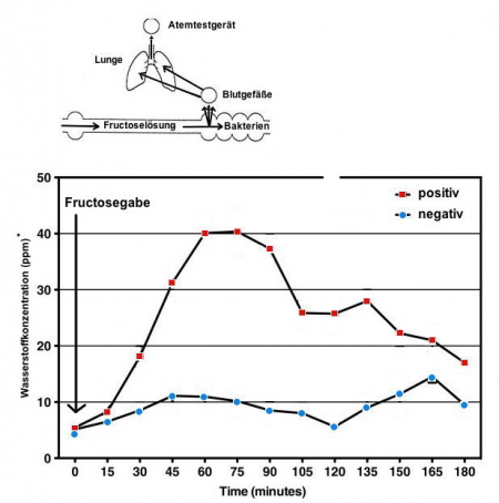 AB 6_2.1 Früchte können auch Beschwerden machen - Fructoseintoleranz